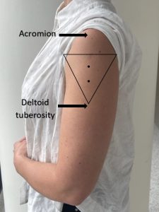 Shoulder injury related to vaccine administration (SIRVA) - The ...